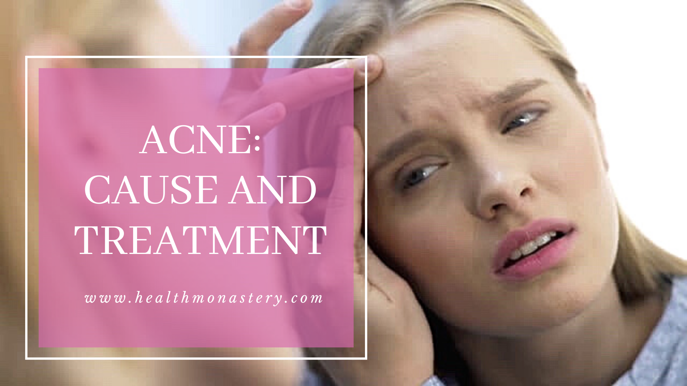 Acne: Causes and Treatment